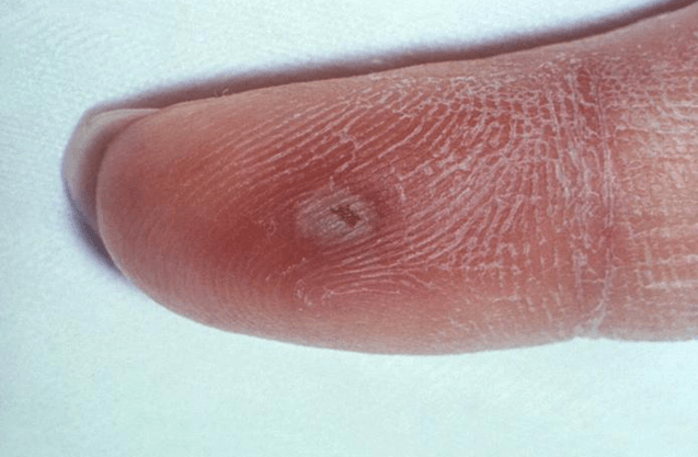 Simulazioni Casi FB Foto - 0226-0228