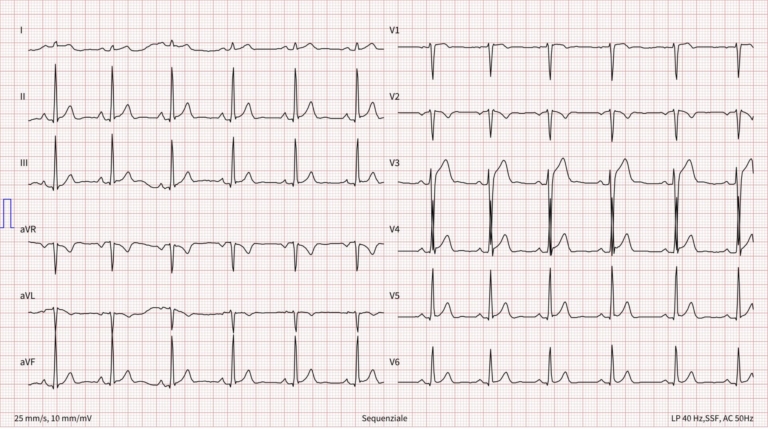 Simulazione Pro 023C (40 ECG)