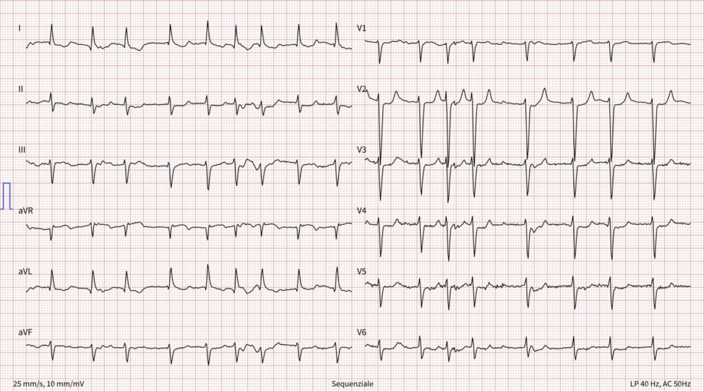 ECG Refertati 01 Demo