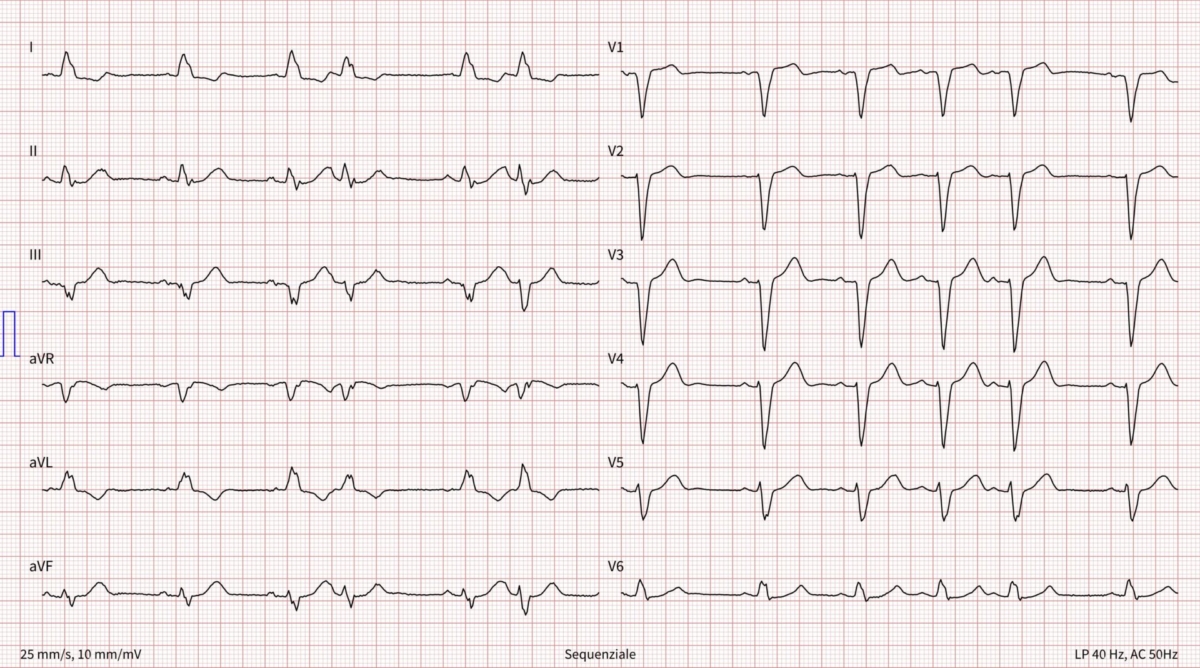 ECG Refertati 01 Demo