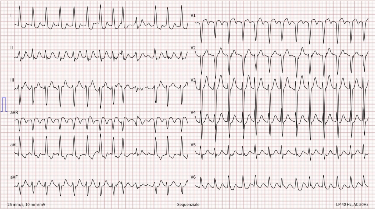 ECG Refertati 01 Demo